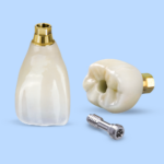 Crown World Dental Price List