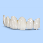 Crown World Dental Price List