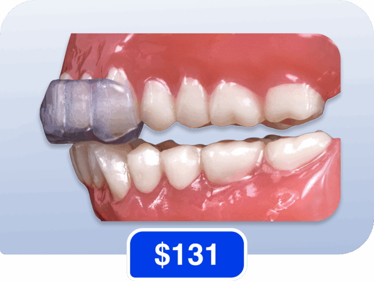 NTI Night Guard Device | Bruxism & TMJ Appliance for Dentists | Crown World