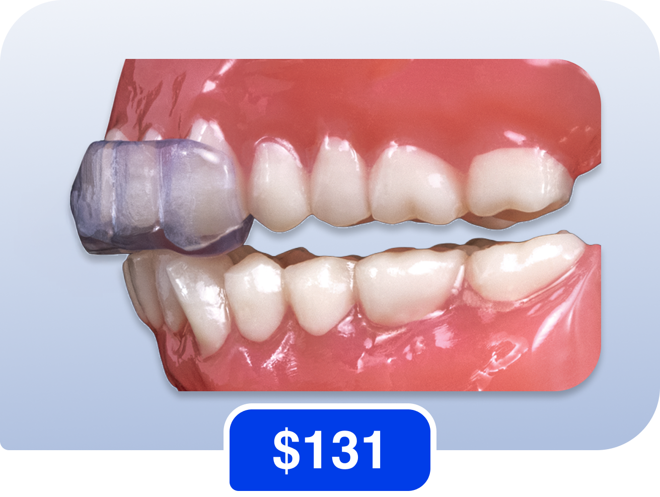 NTI-tss Plus® and NTI OmniSplint®